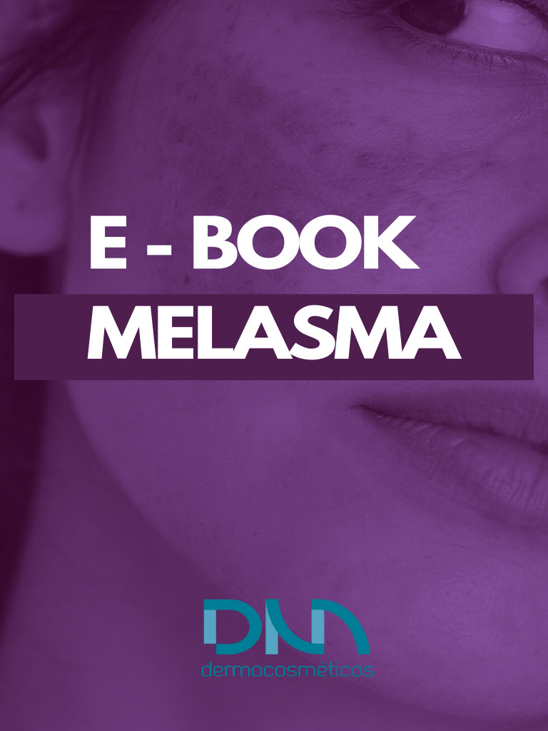 E-Book Melasma | PDF | Pele | Especialidades médicas