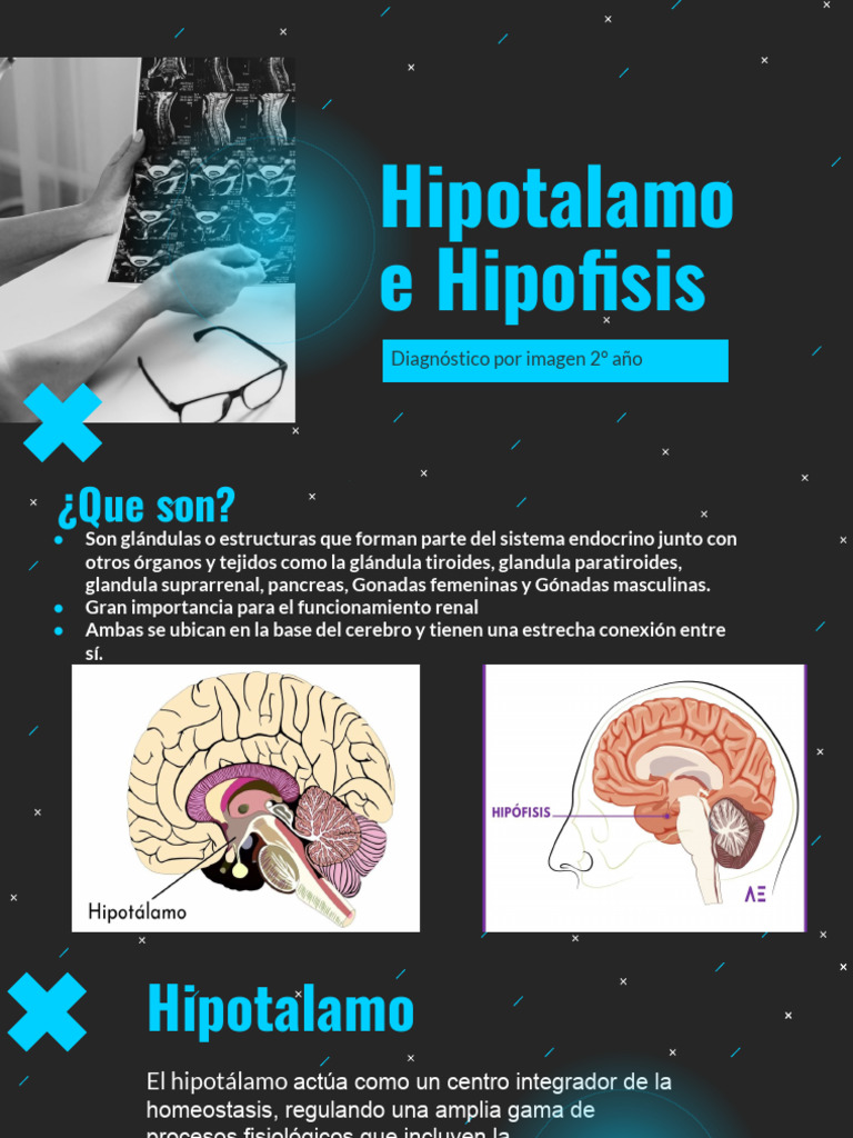 Hipotalamo e Hipofisis | PDF | Hipotálamo | Glándula pituitaria