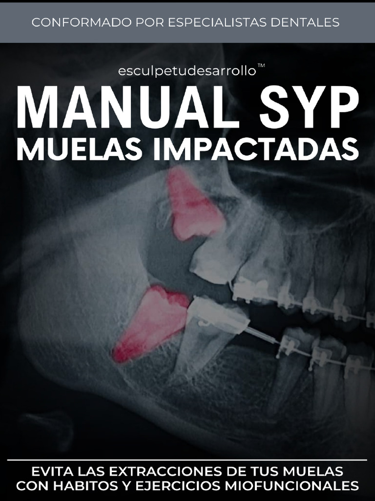Esculpetudesarrollo - Manual Para Las Muelas Impactadas | PDF ...