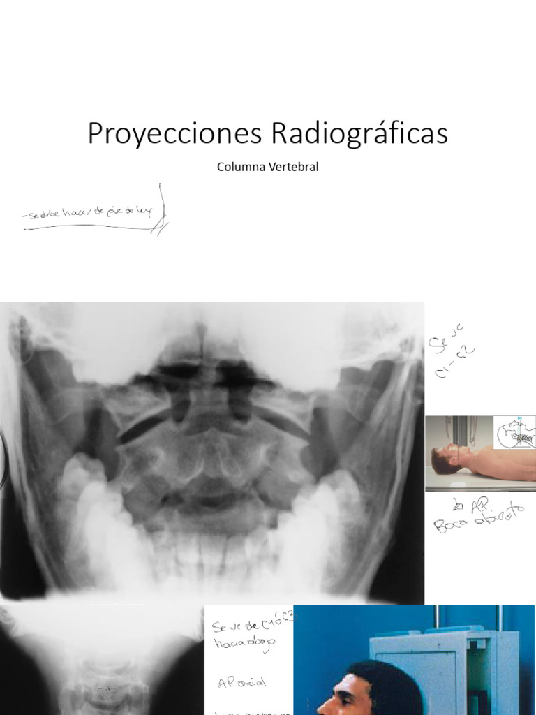 010 Columna Vertebral | PDF