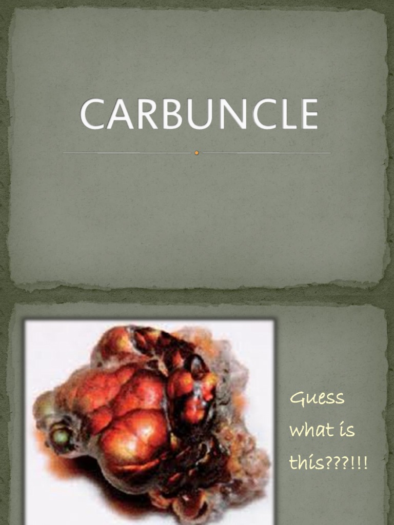 Carbuncle | PDF | Microbiology | Medicine