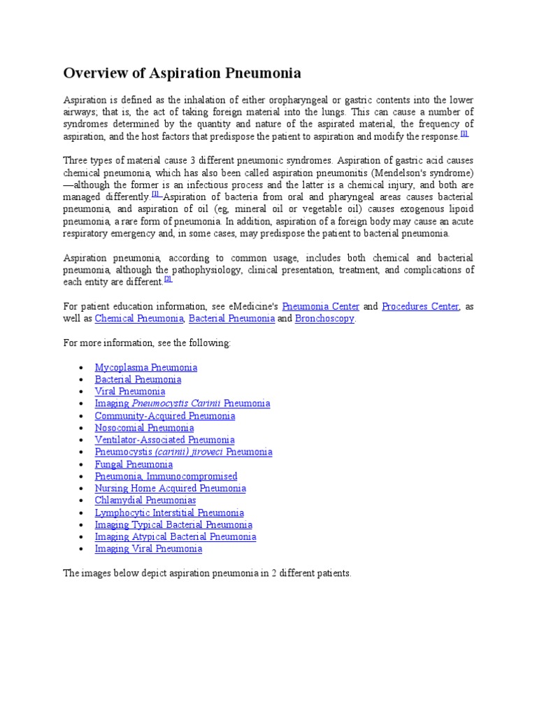 Understanding Aspiration Pneumonia | PDF | Pneumonia | Sepsis