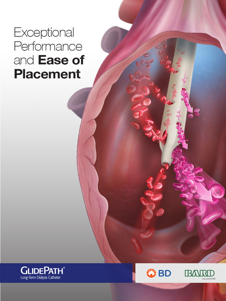 Ease of Placement: Exceptional Performance and | PDF | Blood Pressure ...