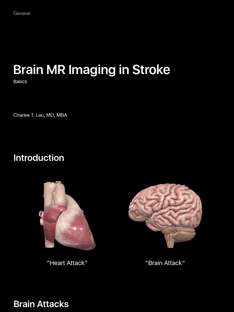Brain MR Imaging in Stroke | PDF | Stroke | Medical Emergencies