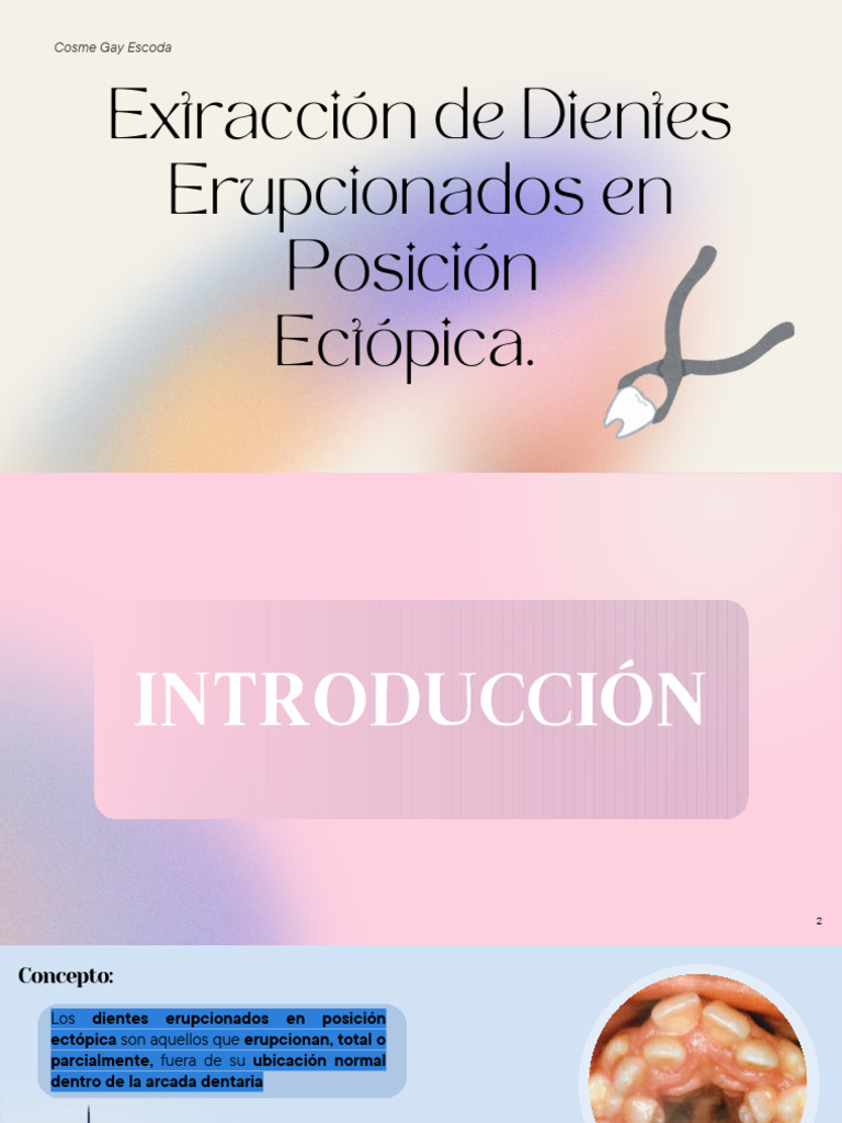 Dientes Ectópicos | PDF | Diente | Anatomia dental