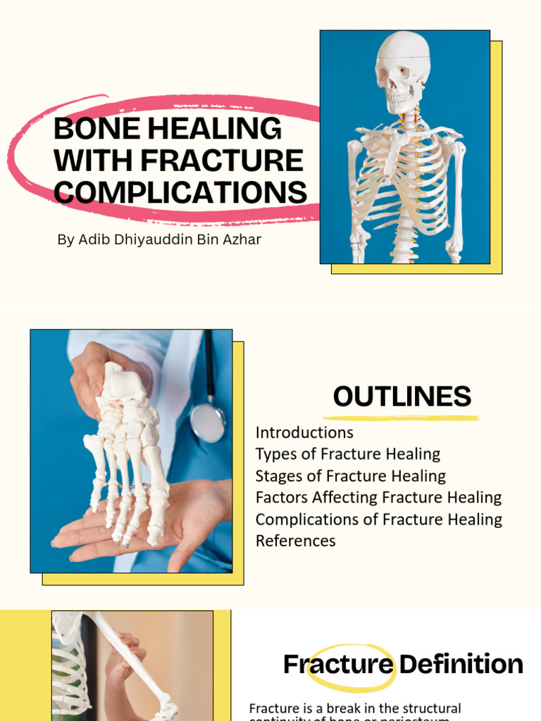 Bone Healing With Fracture Complications | PDF | Bone | Medical Specialties