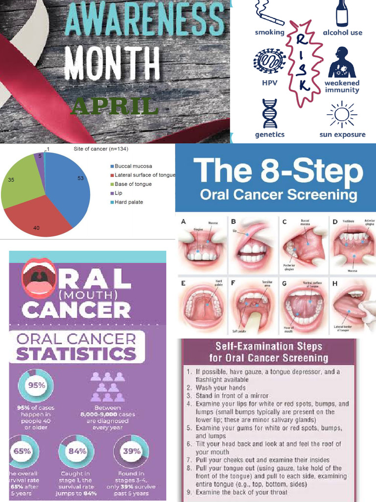 Oral Cancer Poster | PDF