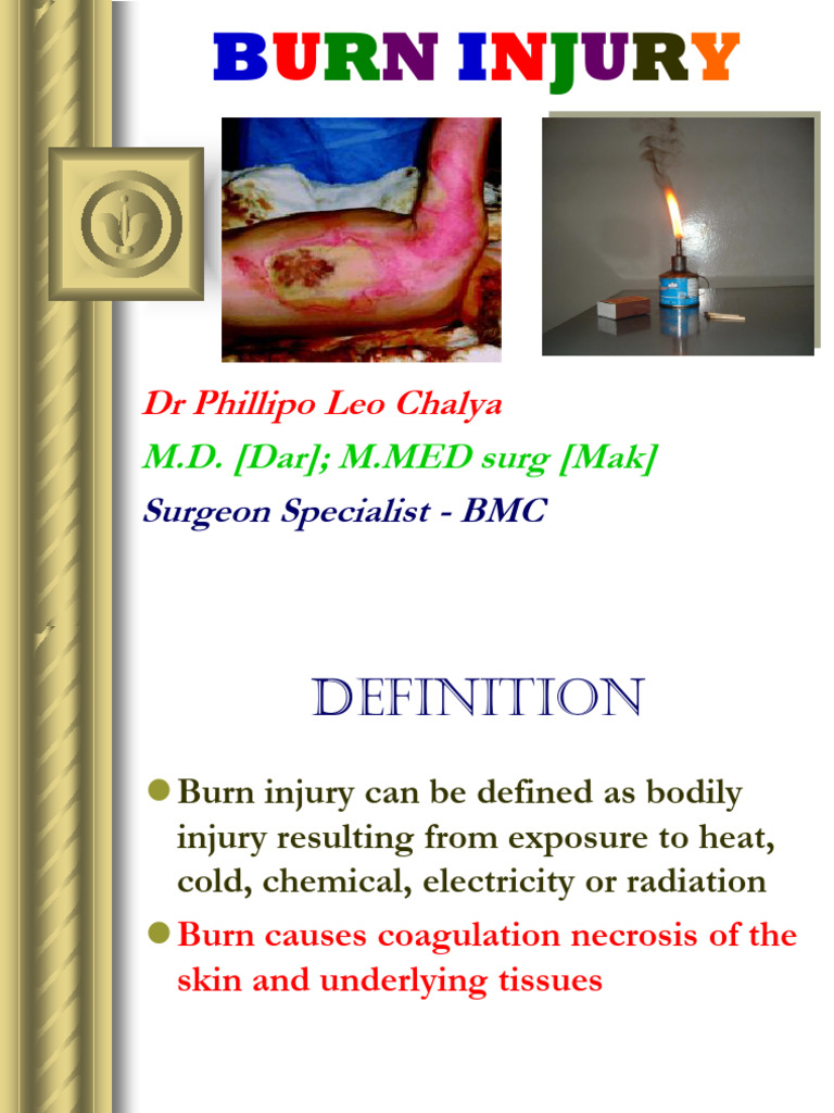 Burn Injury | PDF | Burn | Wound