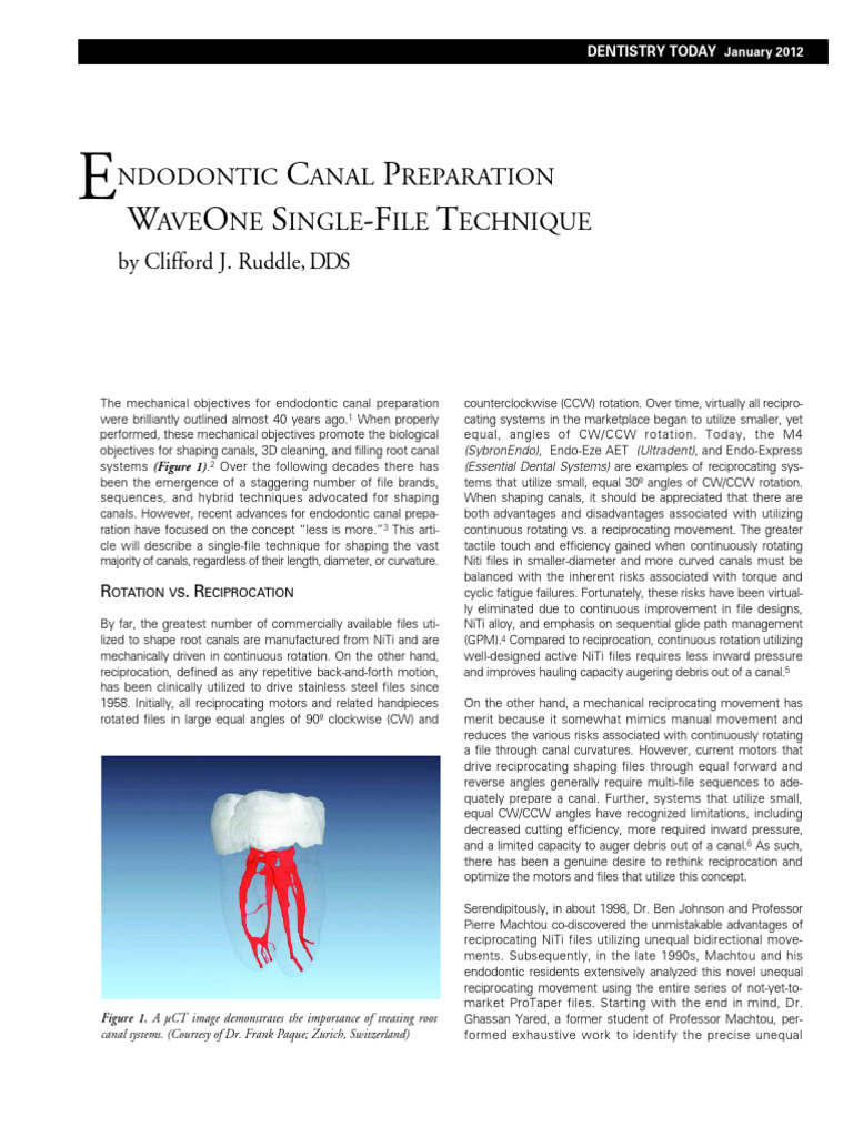 Endodontic Canal Preparation Waveone Single-File Technique ... | PDF