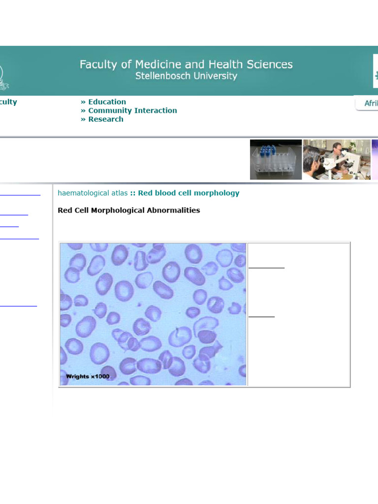RBC Shapes | PDF | Anemia | Red Blood Cell