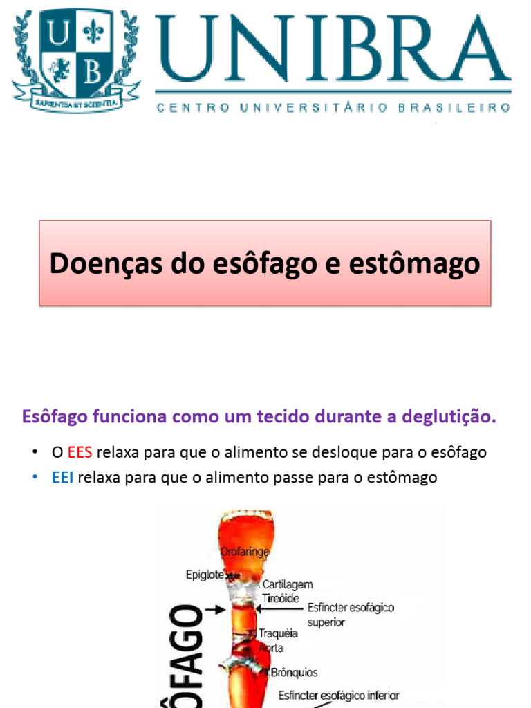 2 - DoenÃ As Do Esã Fago e Estã Mago | PDF | Doença do refluxo ...