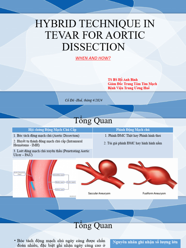 1. Hybrid Technique in Tevar for Aortic Dissection- Ho Anh Binh | PDF