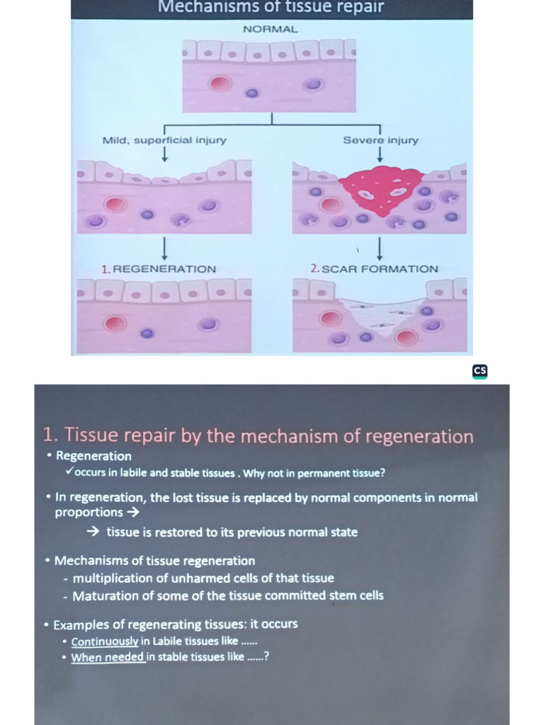 Mechanisms of Tissue Repair Pathology | PDF