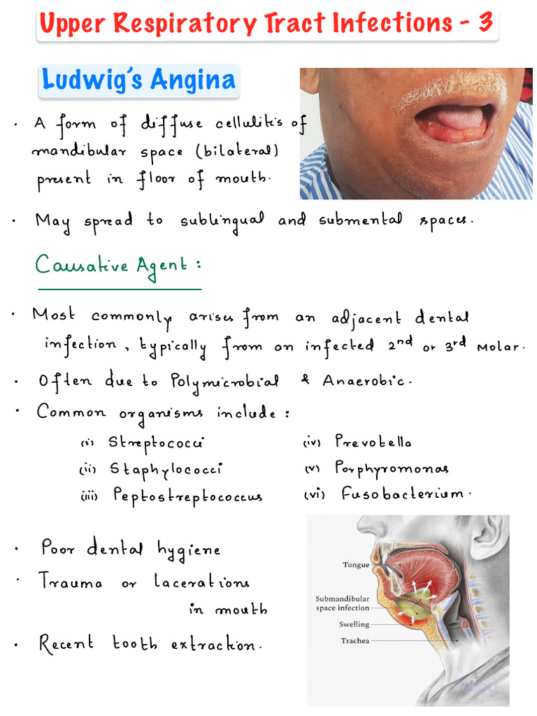 3. URTI - Ludwig’s Angina, Rhinitis, Sinusitis | PDF | Medical ...