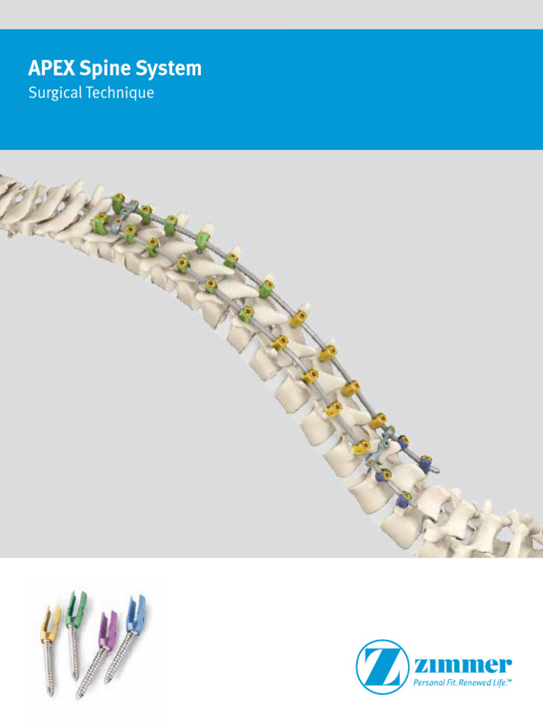 Apex Spine System Surgical Technique | PDF | Vertebra | Scoliosis