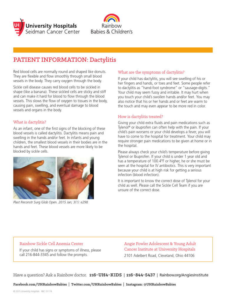 httpswww.uhhospitals.orgrainbowservicespediatric-cancer-and-blood ...