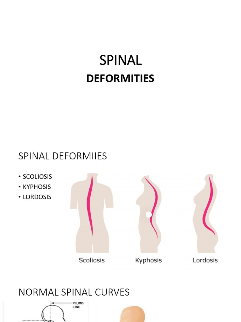 SPINAL DEFORMITIES | PDF