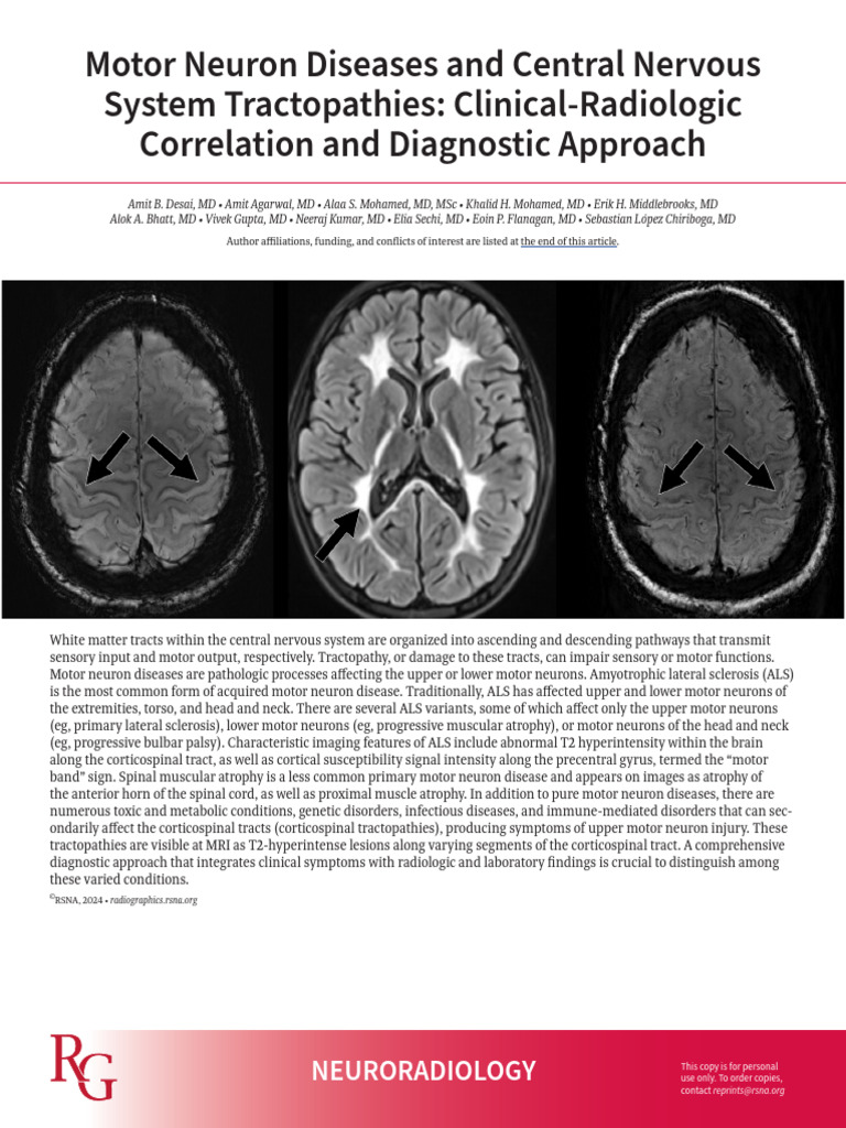 Desai Et Al 2024 Motor Neuron Diseases and Central Nervous System ...