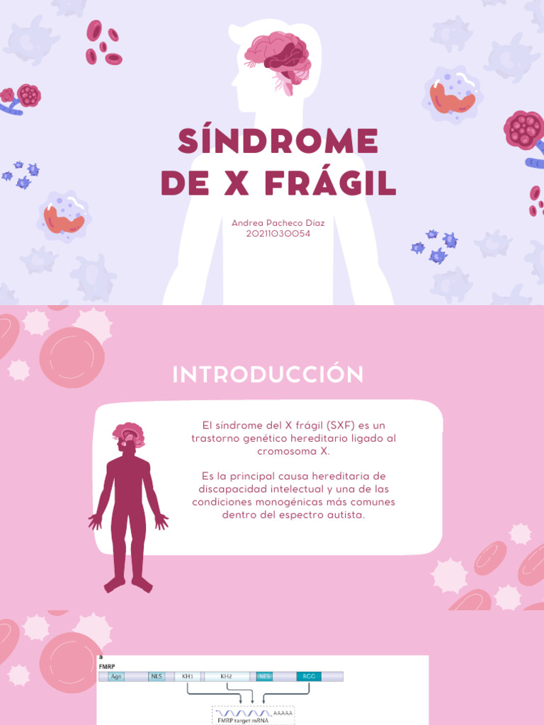 Síndrome de X frágil | PDF | Enfermedades y trastornos | Enfermedades y ...