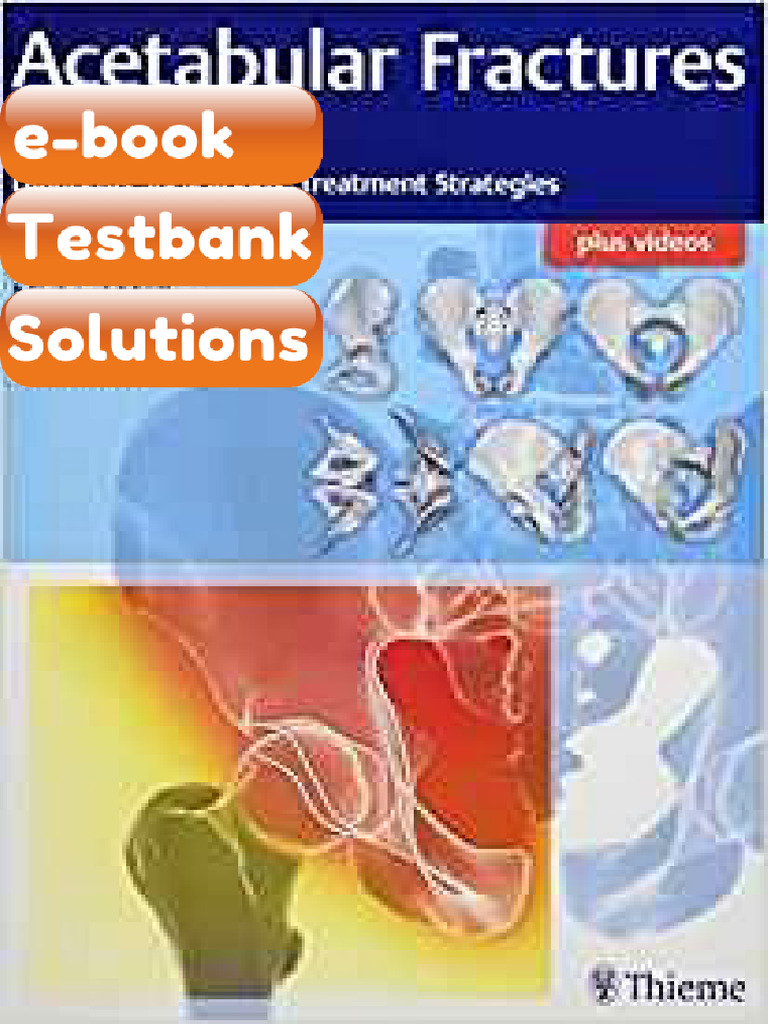 Testbank Acetabular Fractures Diagnosis Indications Treatment ...