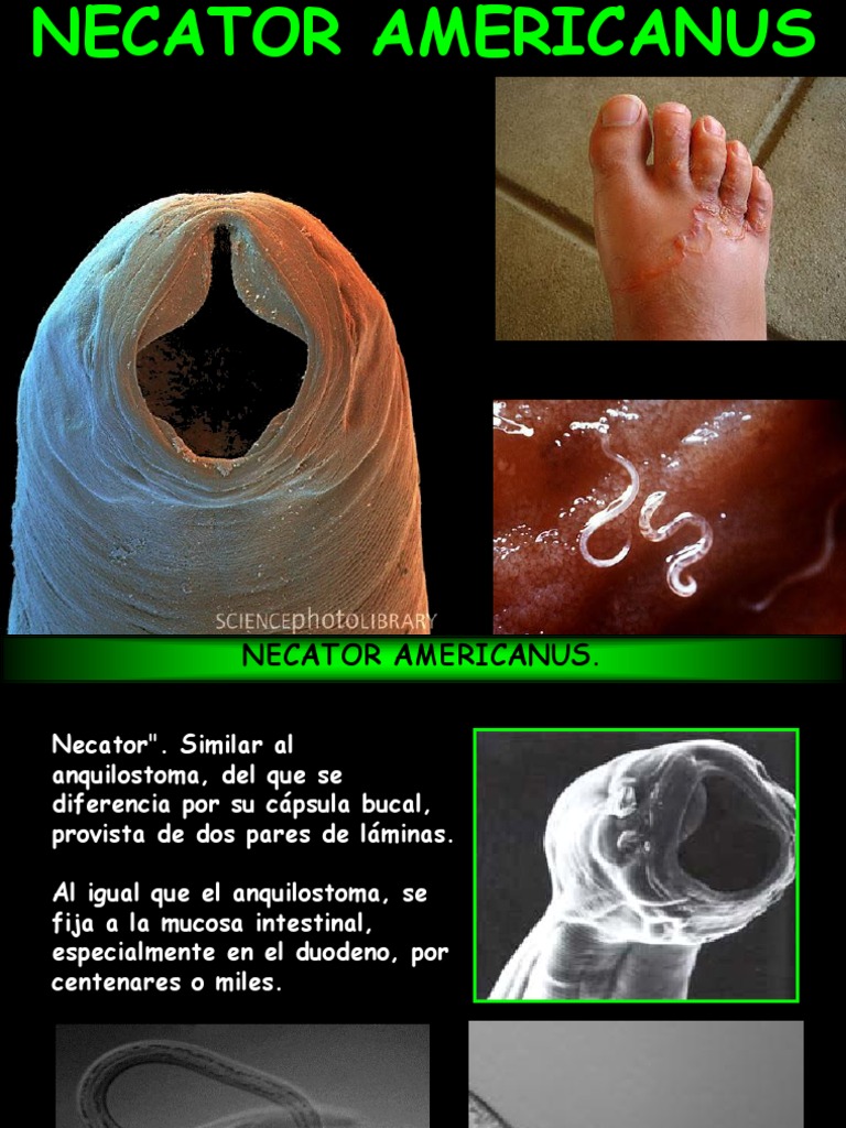 Necator | PDF | Especialidades Medicas | Enfermedades animales