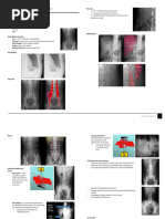 Complete Abdominal Ultrasound Protocol | PDF | Liver | Gallbladder