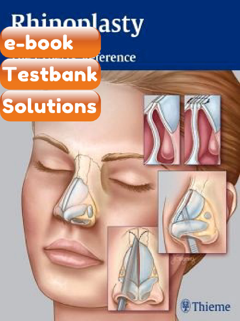 Testbank Rhinoplasty the Experts Reference Fast Download | PDF ...
