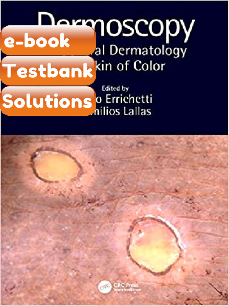 Testbank Dermoscopy in General Dermatology for Skin of Color by Enzo ...