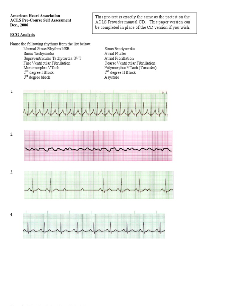 Coarse Ventricular Tachycardia