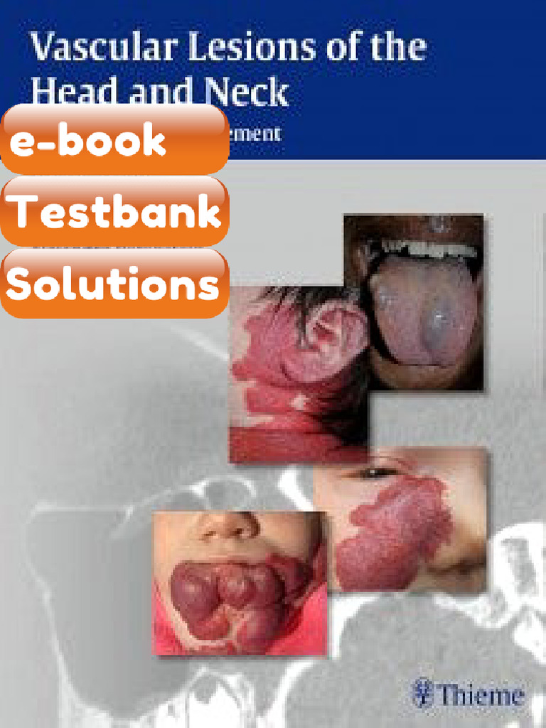 Testbank for Vascular Lesions of the Head and Neck Diagnosis and ...