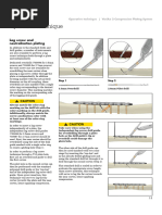 Dart-Fire Small Screw System Guide | PDF | Implant (Medicine) | Screw