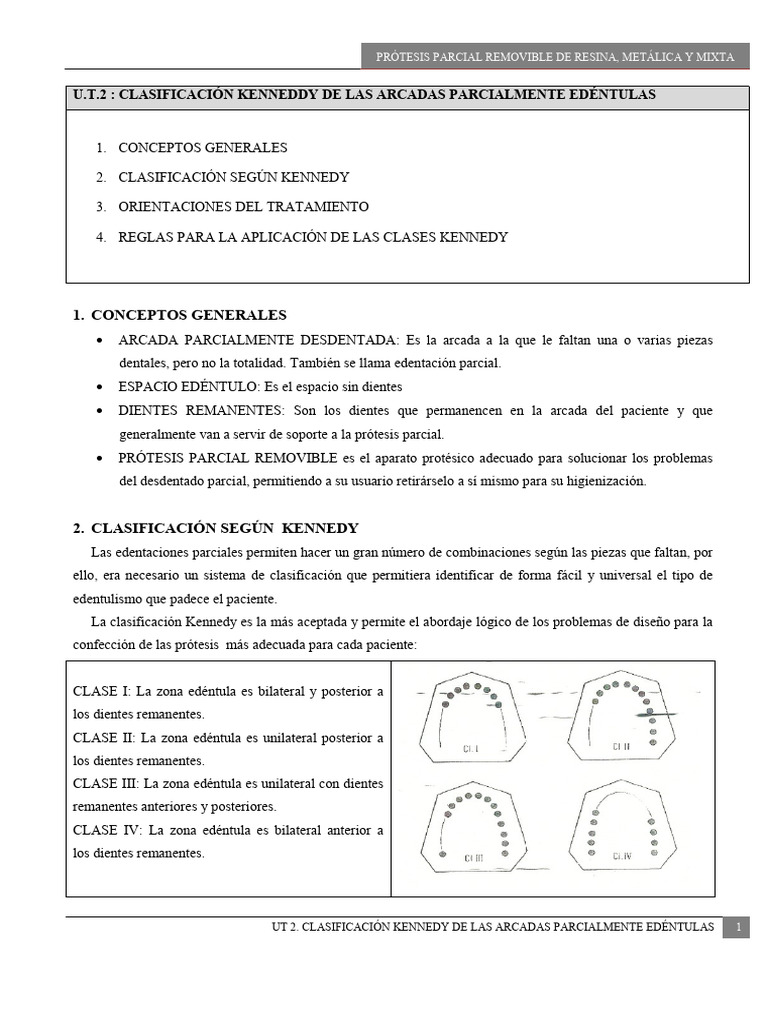Ut 2. Clasificación Kennedy de Las Arcadas Parcialmente Edéntulas ...
