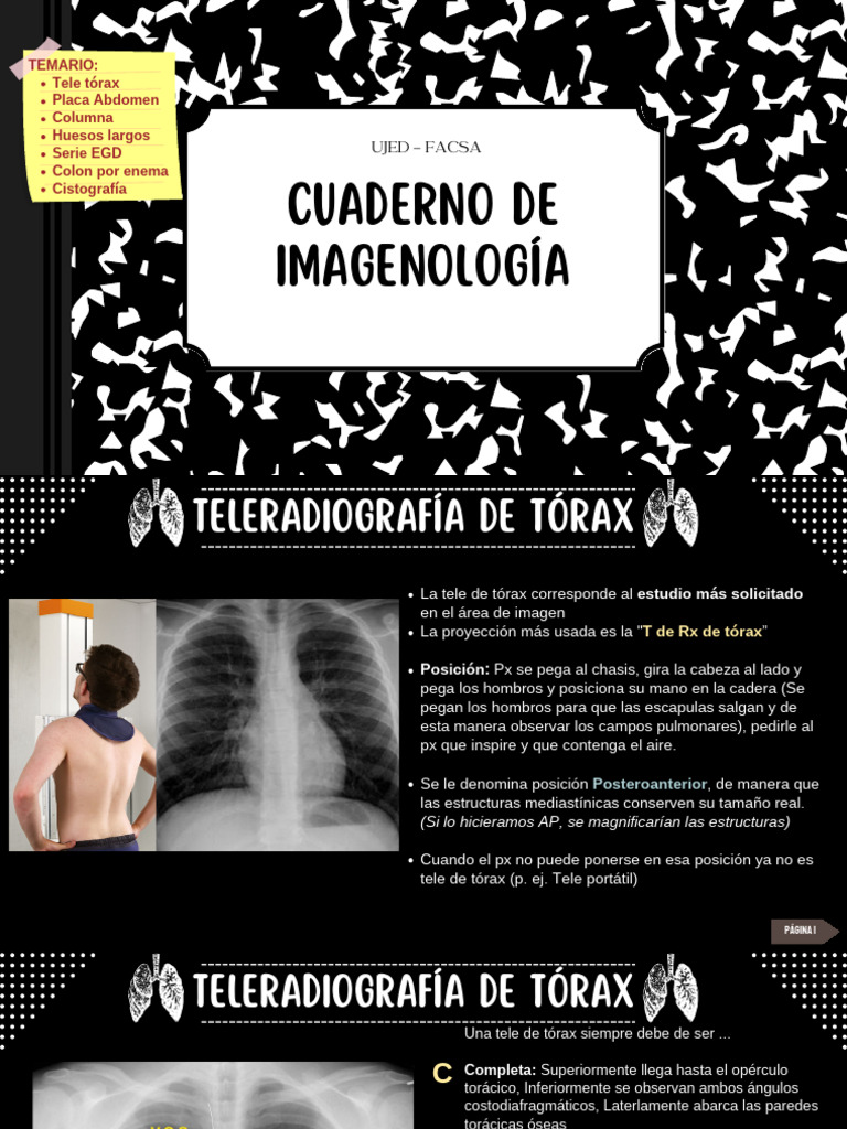 Imagen Yayyy | PDF | Tórax | Pulmón