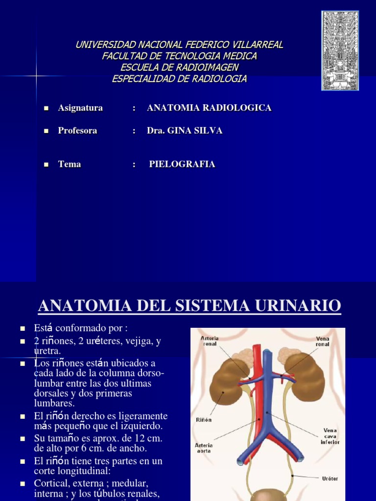 Pielografía: Evaluación Radiológica del Sistema Urinario | PDF | Riñón ...