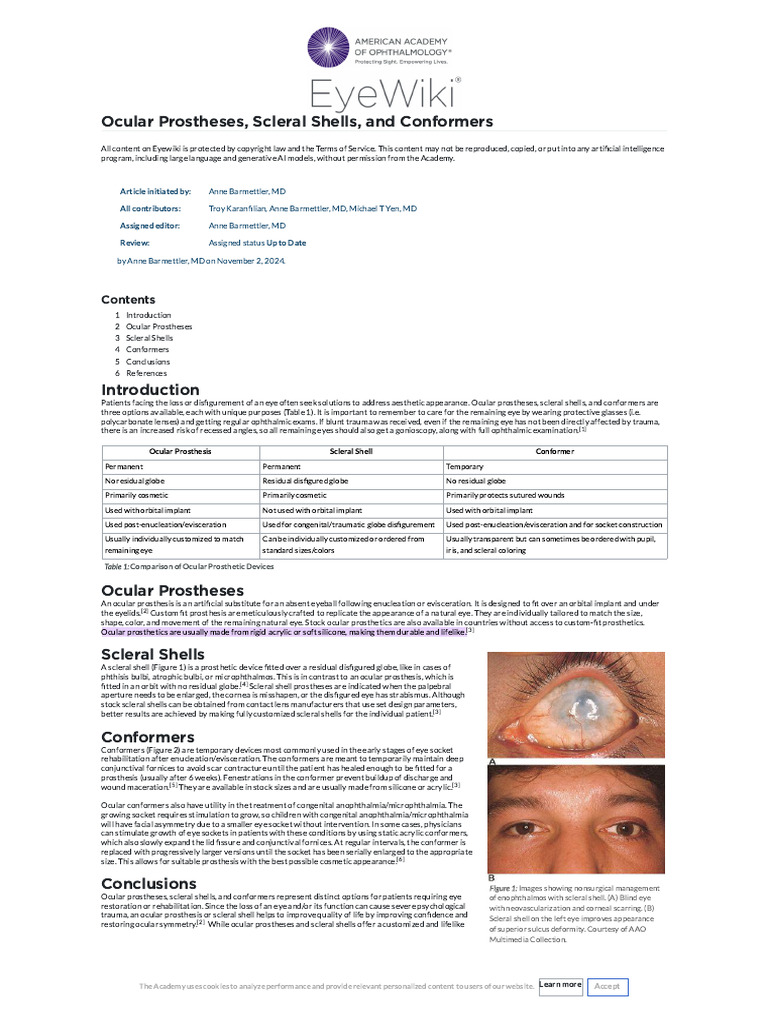 023 Ocular Prostheses, Scleral Shells, and Conformers - EyeWiki | PDF