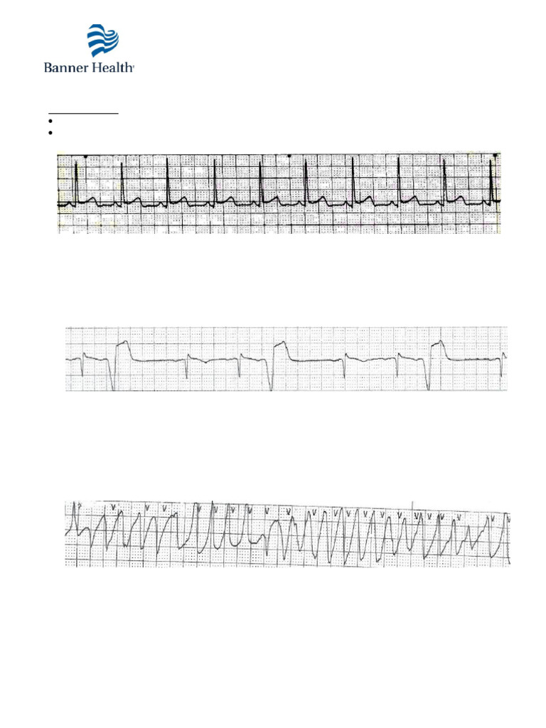 Basic Ecg Interpretation Practice Test v 1 | PDF | Heart | Cardiology