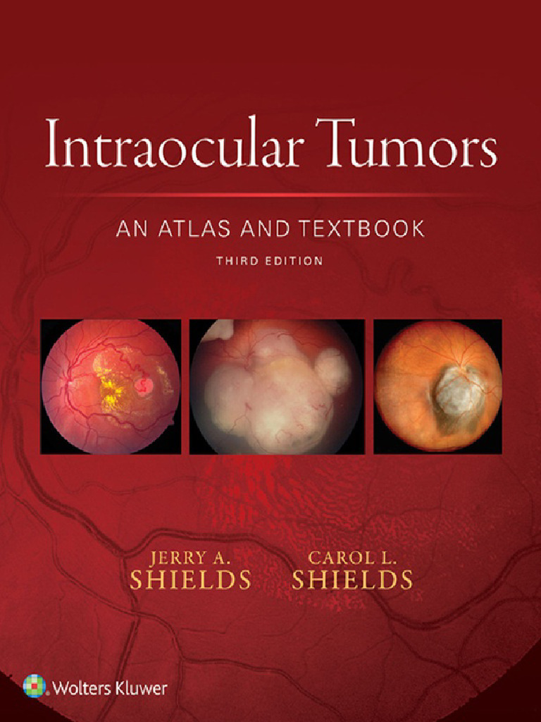 Dr. Jerry a. Shields, Dr. Carol L. Shields - Intraocular Tumors_ an ...