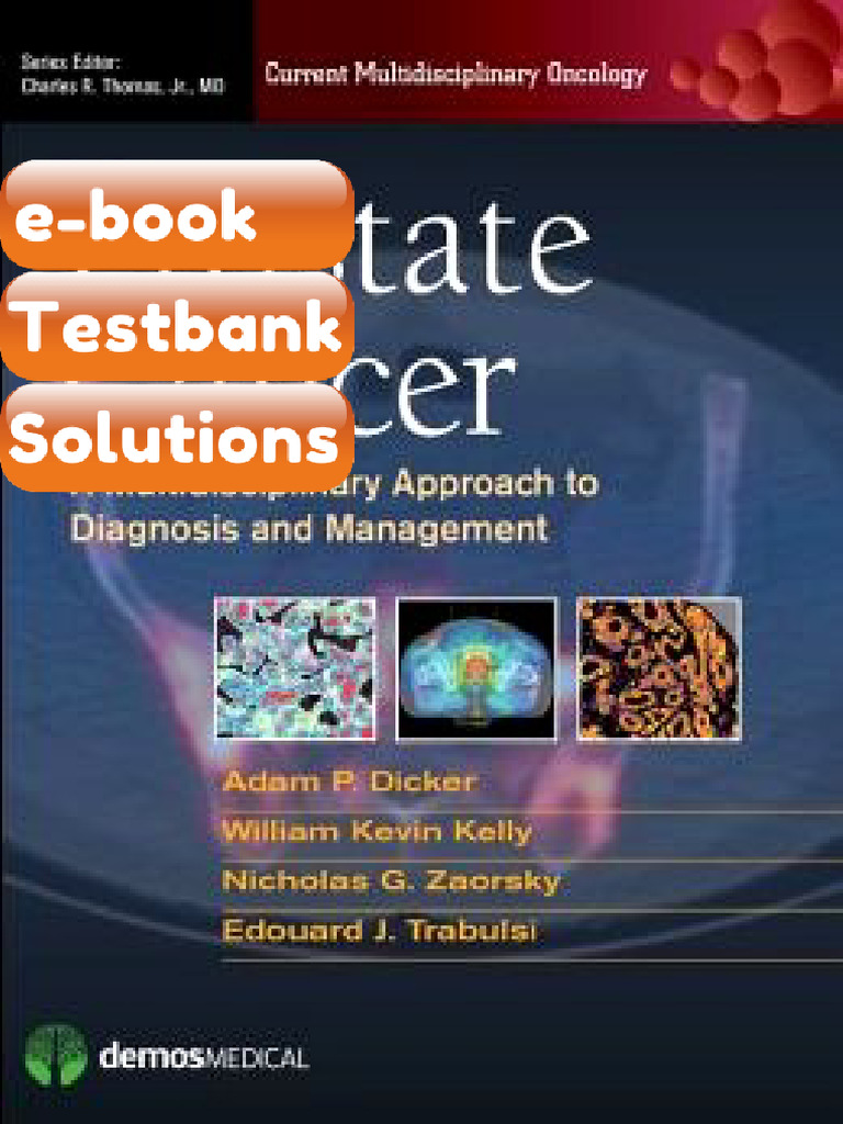 Testbank Prostate Cancer a Multidisciplinary Approach to Diagnosis and ...