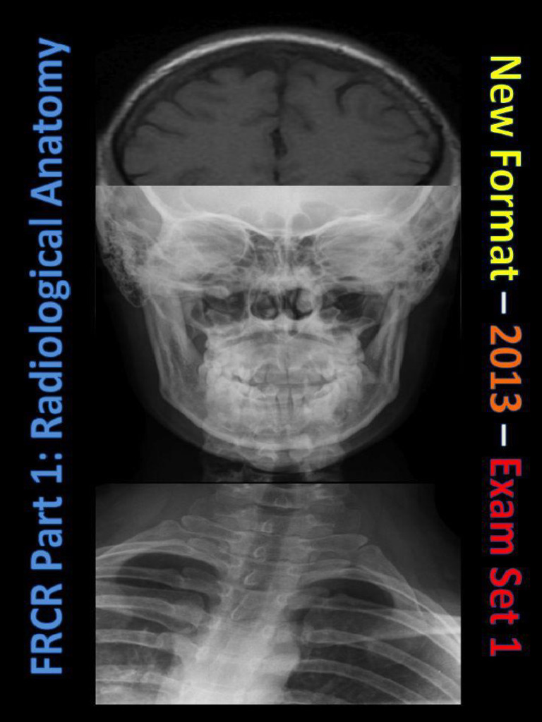 FRCR Part 1_ Radiological Anatomy - New for 2013 - Set 4 | PDF ...