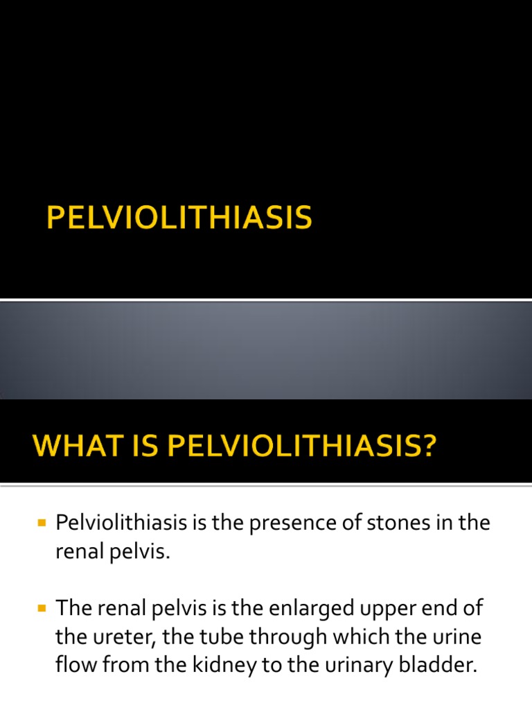 PELVIOLITHIASIS | PDF | Medical Specialties | Clinical Medicine