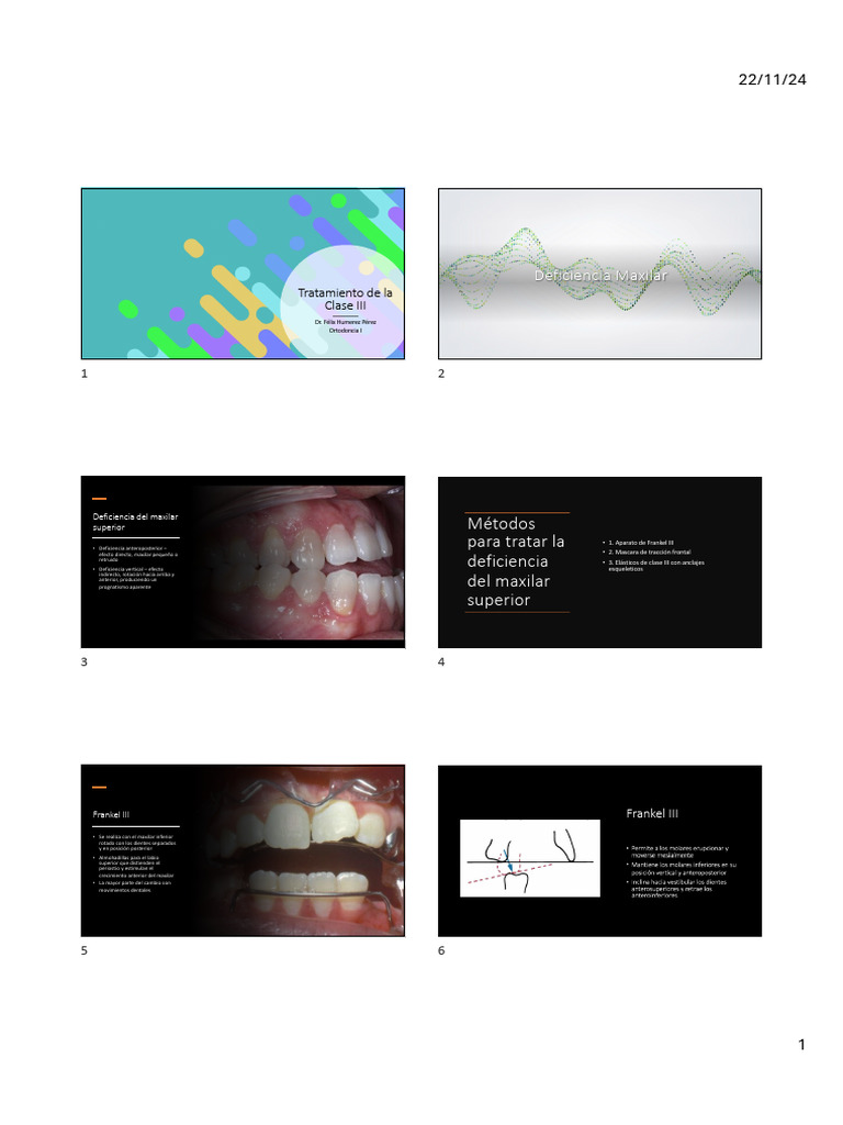 Tratamiento de la Clase III | PDF | Ortodoncia | Especialidades Medicas