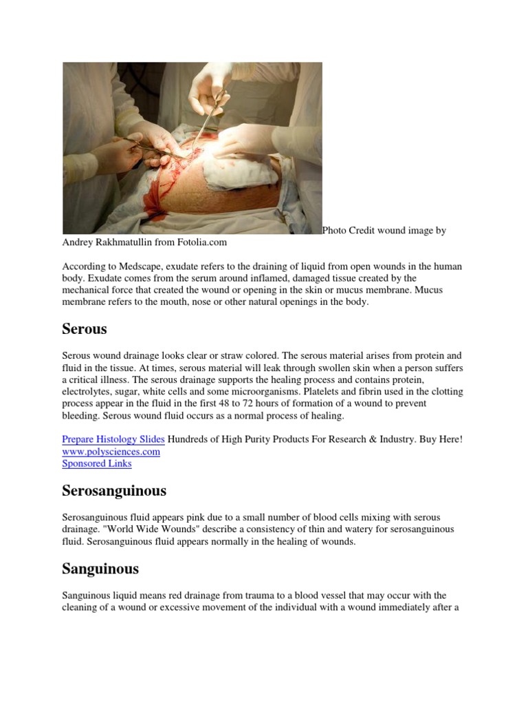 Serosanguinous Drainage