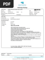 Right Knee CT Report: Tibial Fractures | PDF | Knee | Radiology