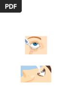 Procedimiento de Lavado Ocular en Urgencias | PDF | Agua | Oftalmología