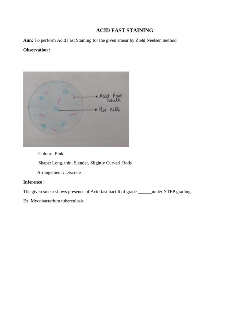 Acid Fast Staining Practicals Model | PDF | Staining | Mycobacterium