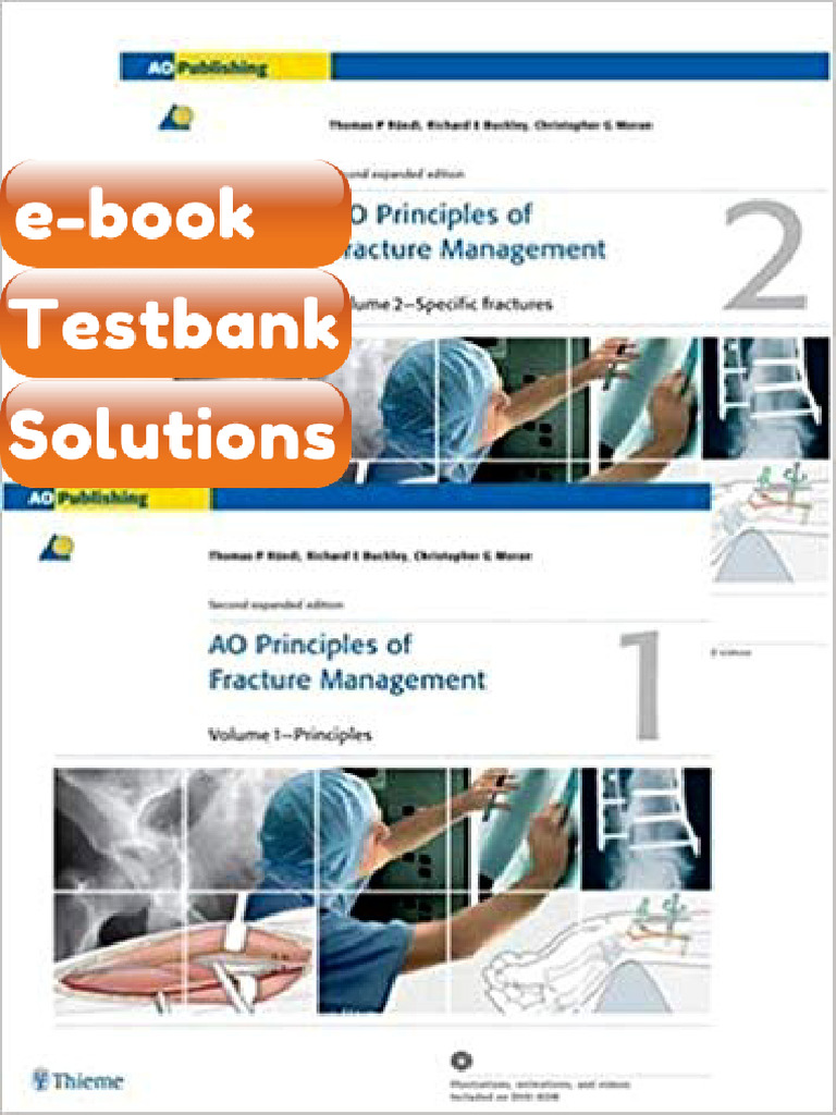 AO Principles of Fracture Management 2nd Expanded Edition by Thomas P ...