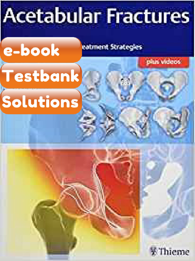 Acetabular Fractures Diagnosis Indications Treatment Strategies ...