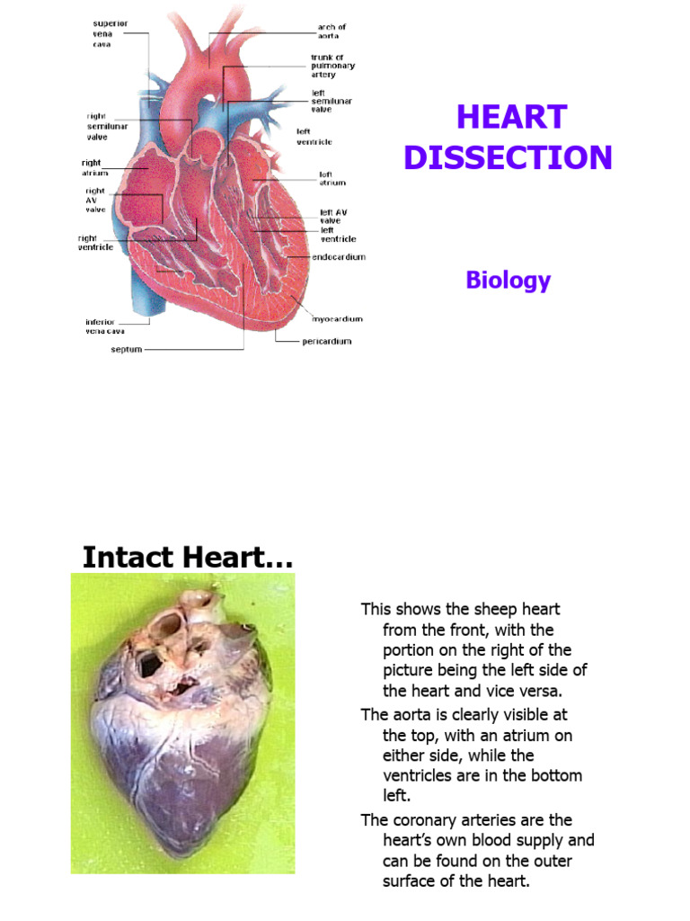 Heart Dissection Slides (For Guidance) | PDF | Heart Valve | Ventricle ...