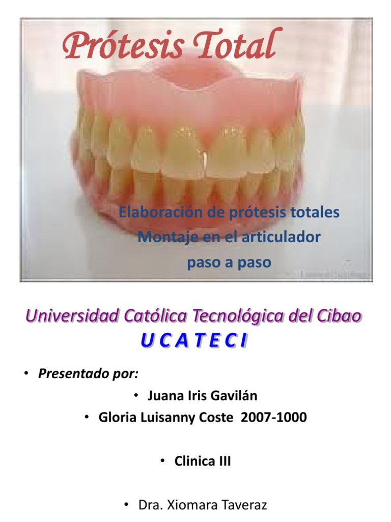 Elaboración de prótesis totales | Dentadura postiza | Boca