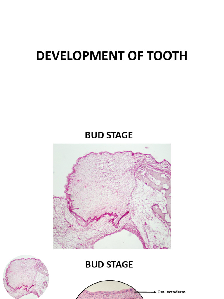 Development of Tooth Practical Diagrams | PDF | Epithelium | Dentistry ...